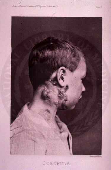 The Six Strangest Medieval Diseases | THE WRITER-LY WORLD OF ANDREA CEFALO